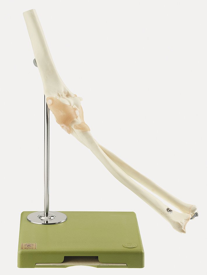 Functional Model of the Elbow Joint - Somso NS52
