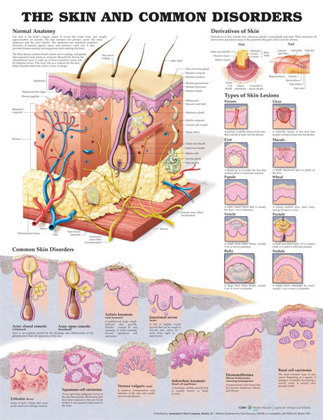 Skin Lesion Different Types Diagram